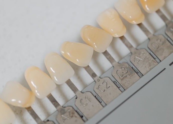 The four most common causes of tooth-discoloration – Gleamery